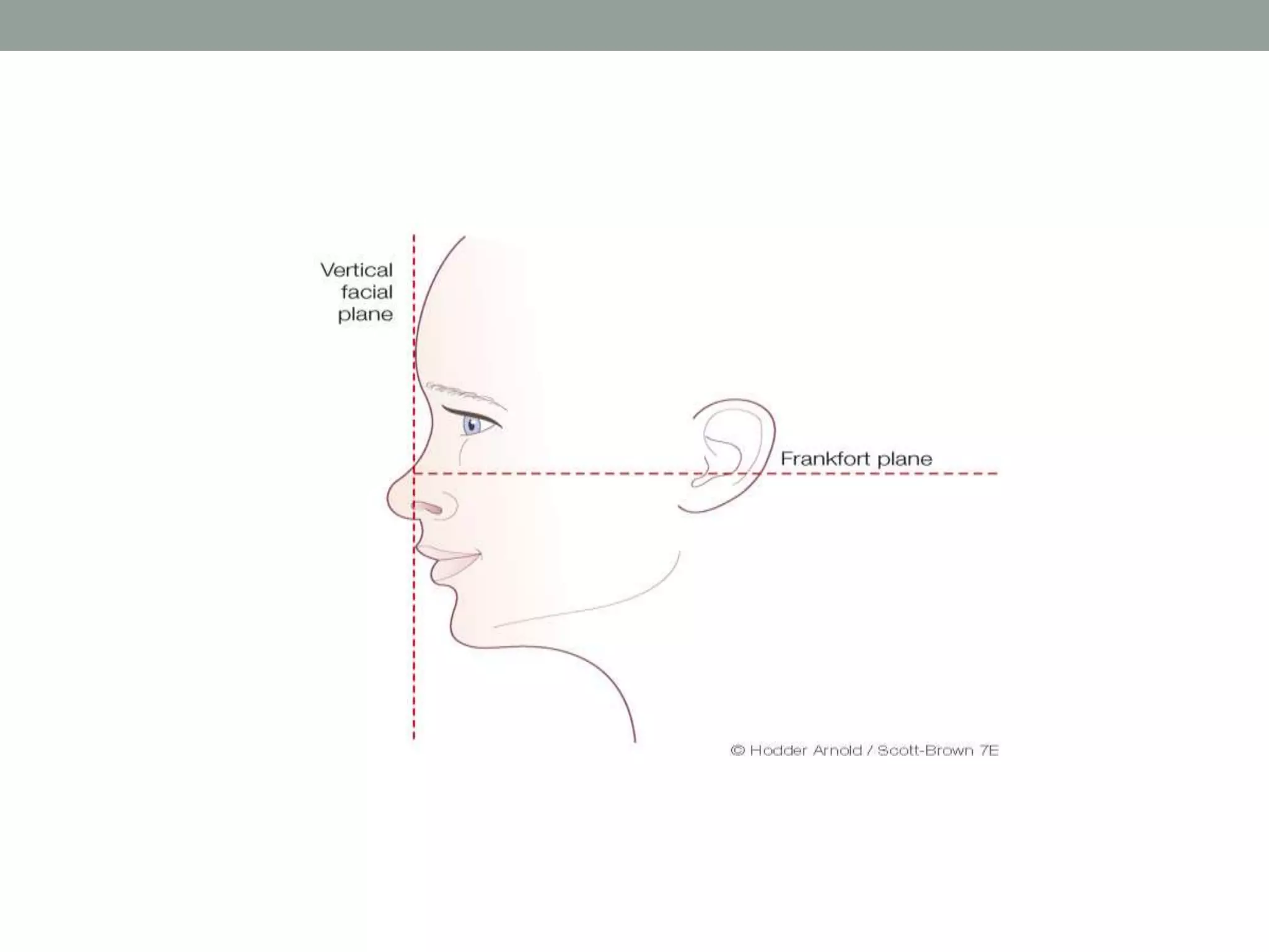 Rhinoplasty | PPTX