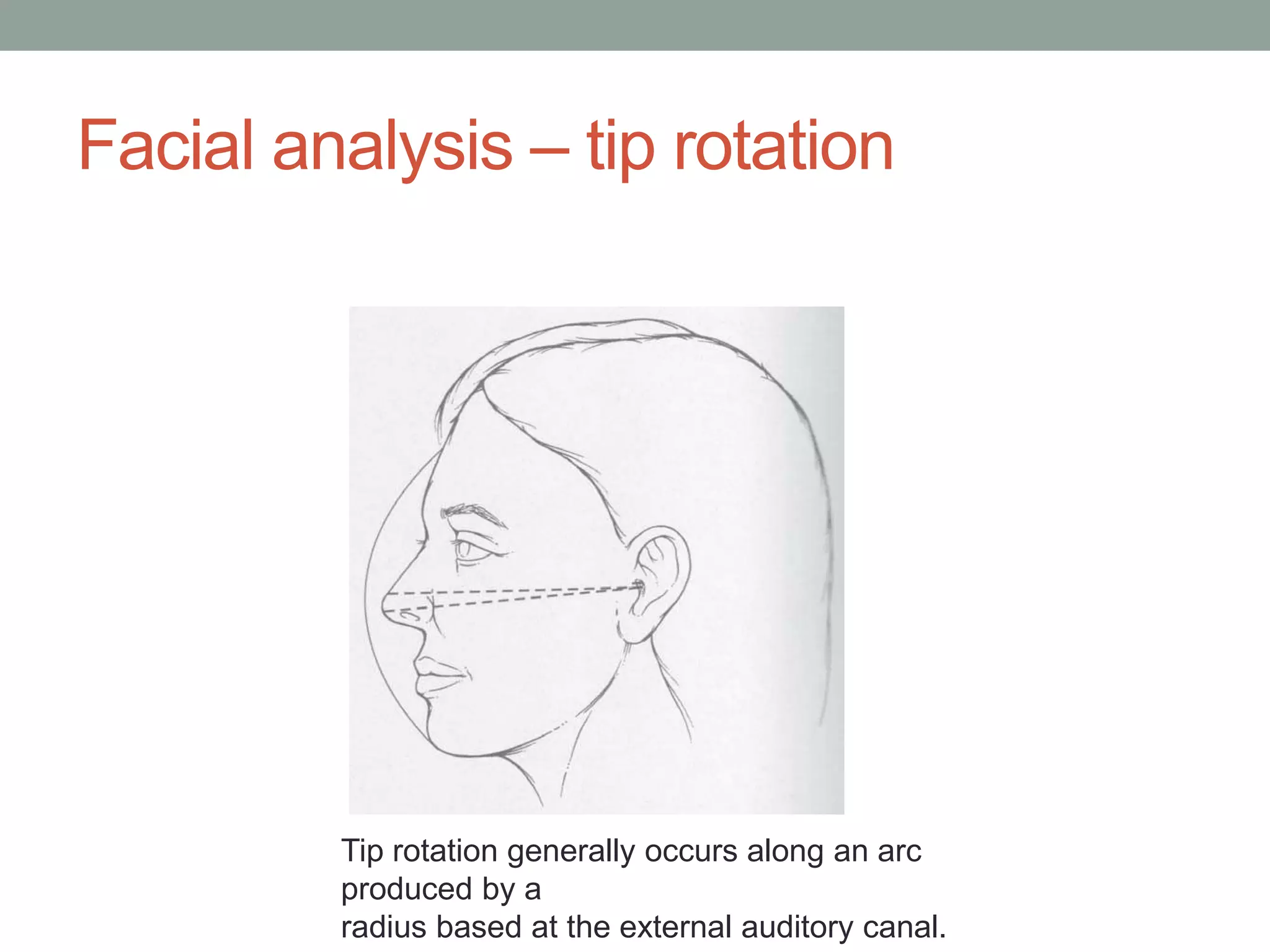 Rhinoplasty | PPTX