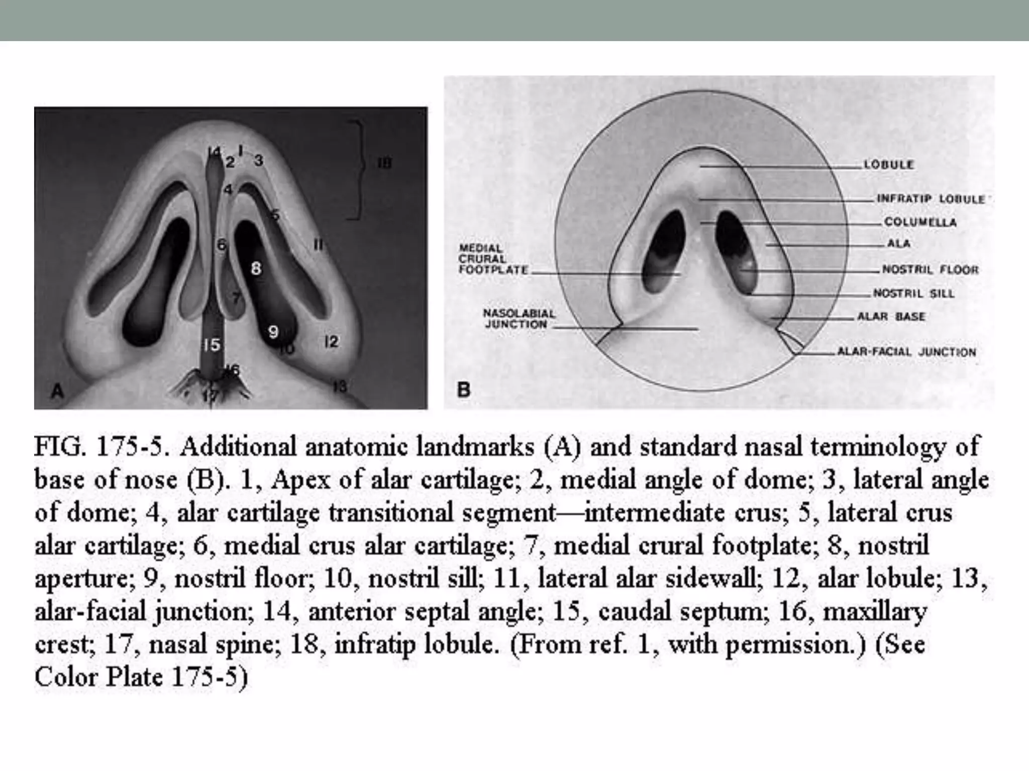 Rhinoplasty | PPTX