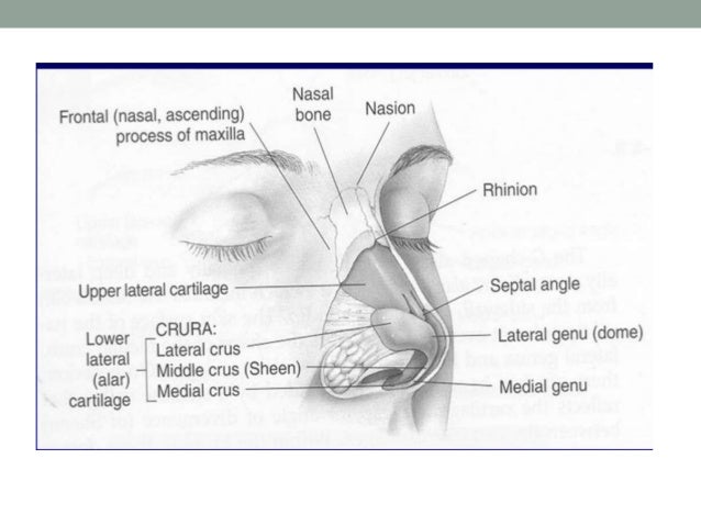 Rhinoplasty