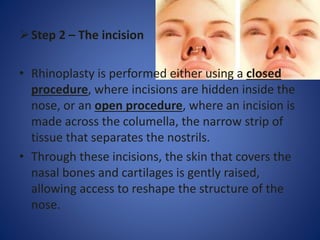 Rhinoplasty | PPTX