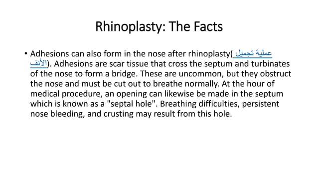 Rhinoplasty.pptx