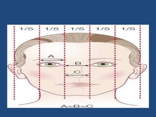 RHINOPLASTY ,Types of incision & Osteotomies.pptx