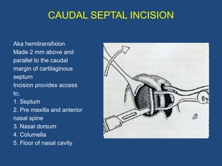 RHINOPLASTY ,Types of incision & Osteotomies.pptx