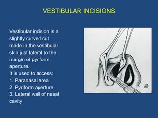 RHINOPLASTY ,Types of incision & Osteotomies.pptx