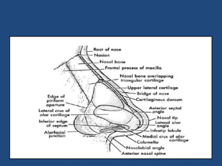 RHINOPLASTY ,Types of incision & Osteotomies.pptx