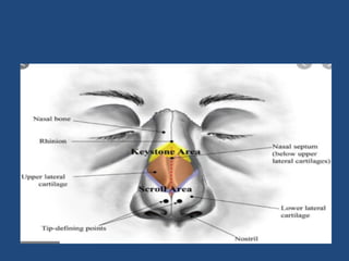 RHINOPLASTY ,Types of incision & Osteotomies.pptx