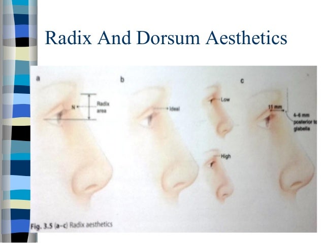 Rhinoplasty approaches ,anatomy,techniques