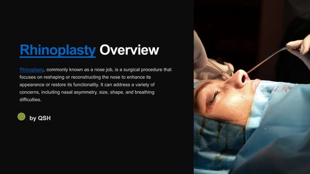 Rhinoplasty-Overview.pptx