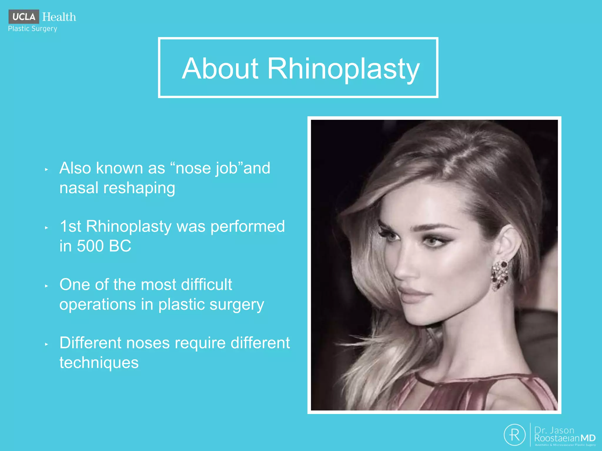 Rhinoplasty | PPTX