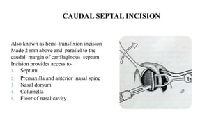 RHINOPLASTY indications and complications | PPTX