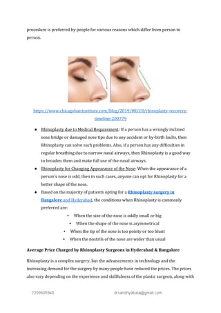 Rhinoplasty recovery timeline and tips | PDF