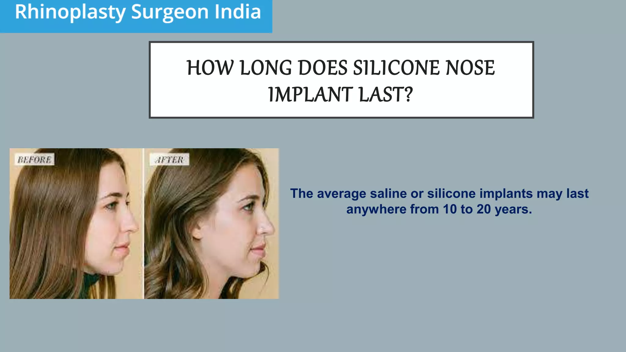 Rhinoplasty Surgeon India - Silicone Implants - PPT.pptx