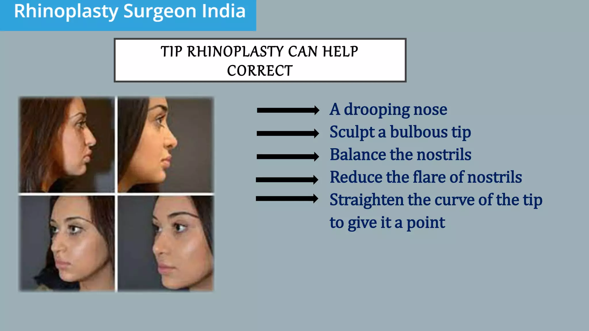 What is Tip Rhinoplasty - Tip Rhinoplasty PPT | PPT