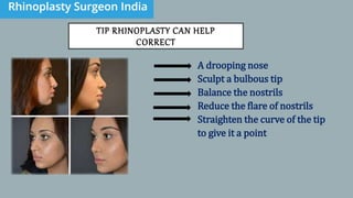 What is Tip Rhinoplasty - Tip Rhinoplasty PPT | PPT