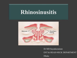 Rhinosinusitis(acute,chronic,fungal) ENT | PPTX