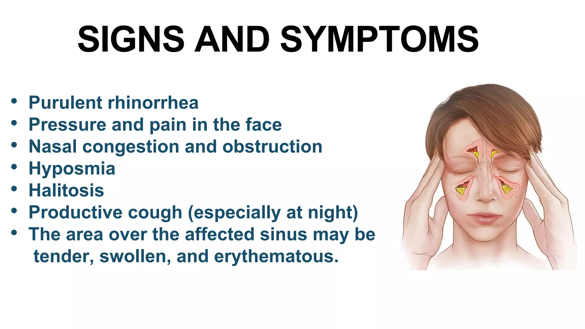 RHINOSINUSITIS | PPTX