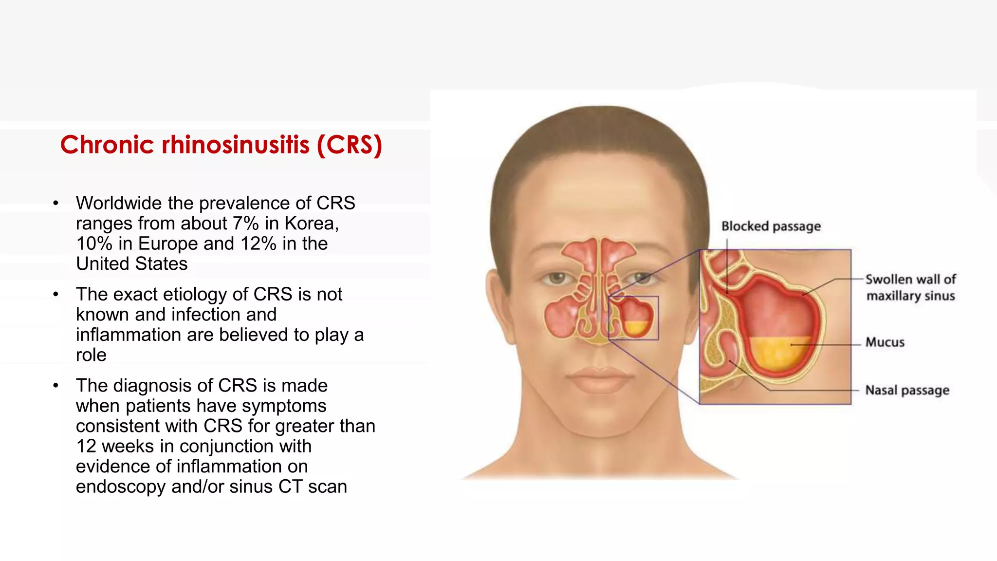 Rhinosinusitis | PDF