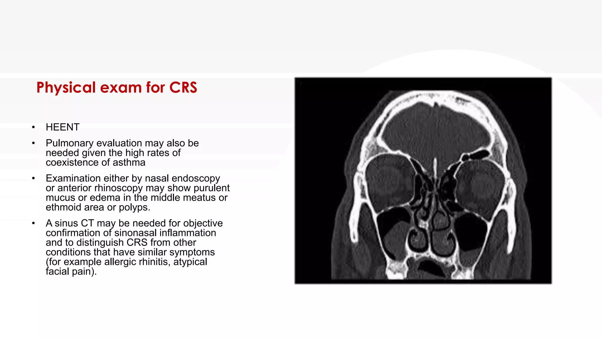 Rhinosinusitis | PDF