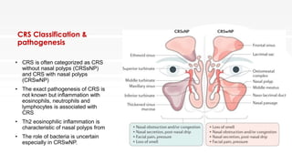 Rhinosinusitis | PDF
