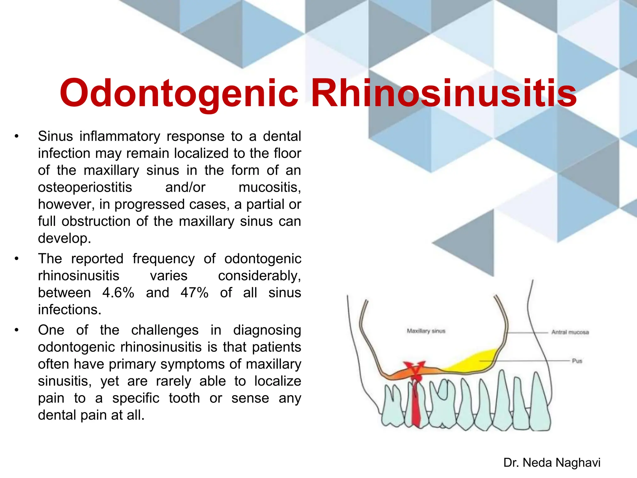 Rhinosinusitis and Endodontic Disease.ppt