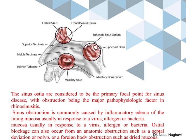 Rhinosinusitis and Endodontic Disease.ppt