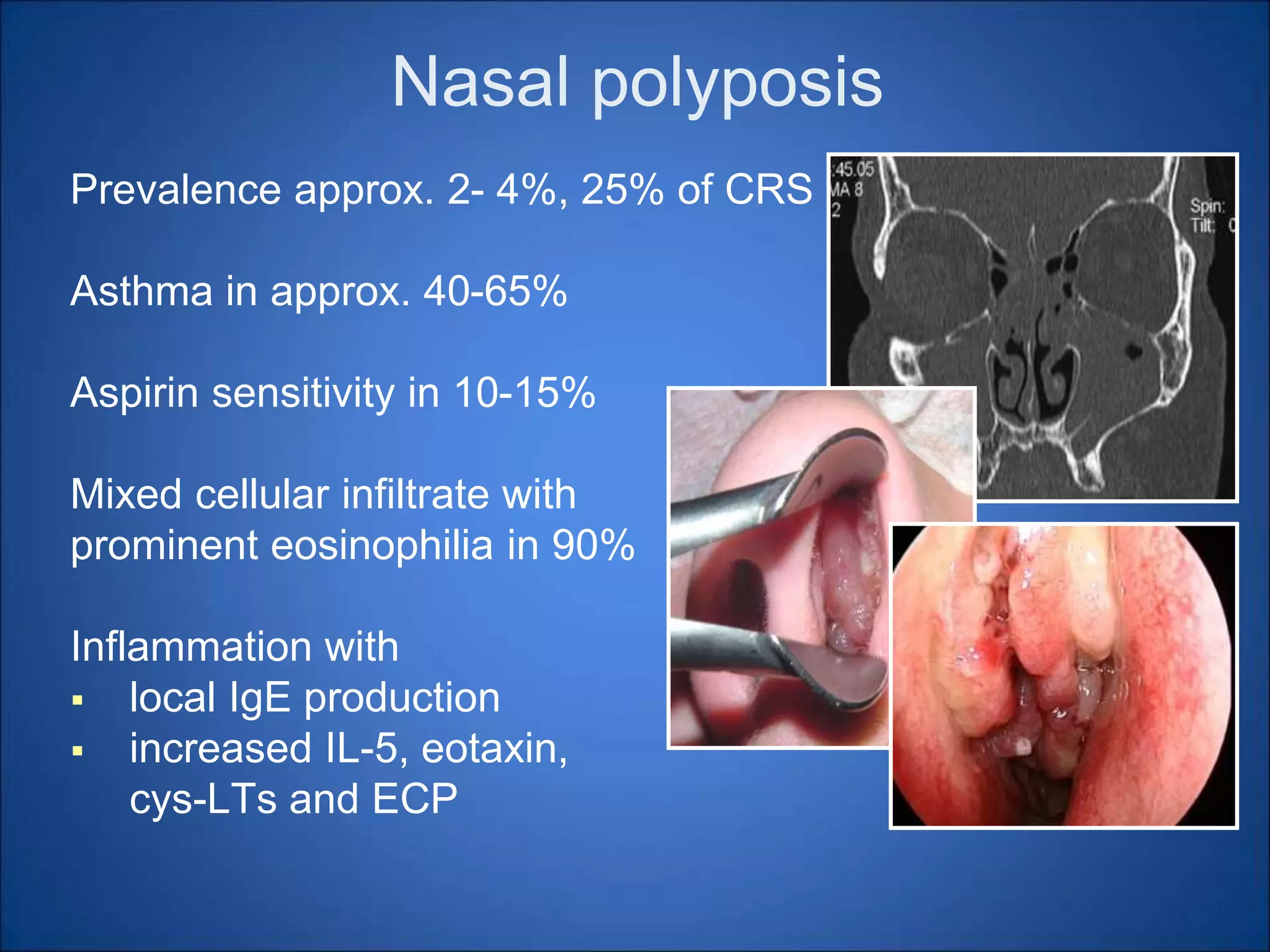 Rhinosinusitis Management. WAC.12-11 (1).ppt