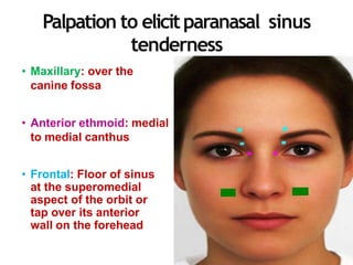 Rhinosinusitis | PPT
