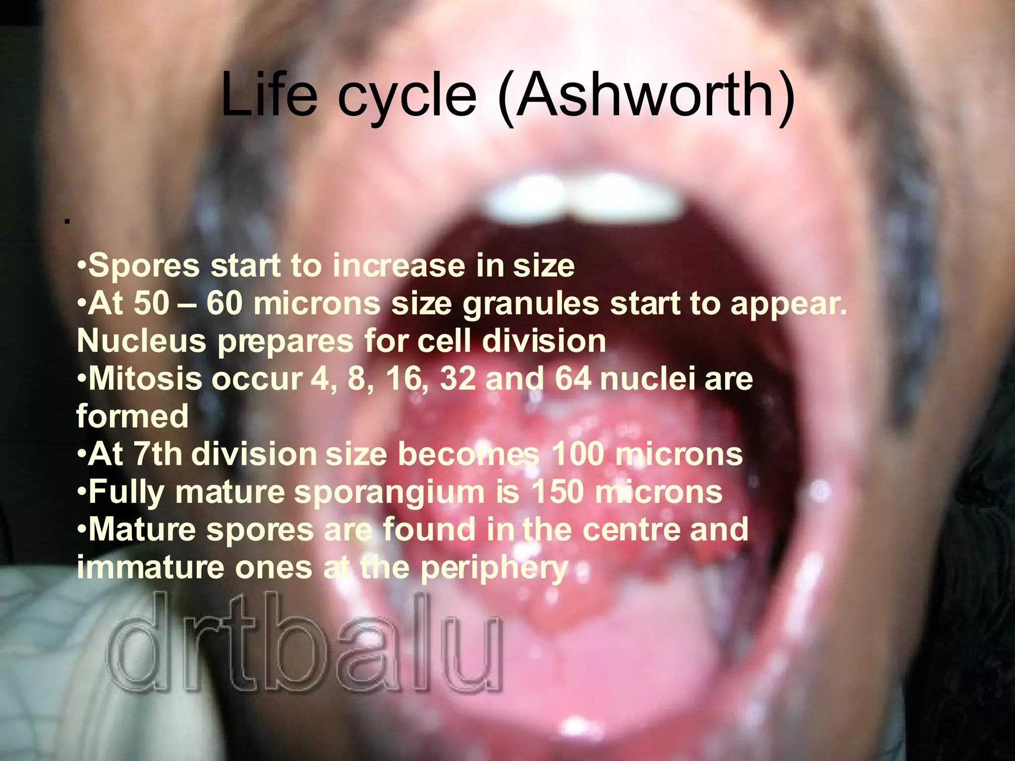 Rhinosporidiosis | PPT