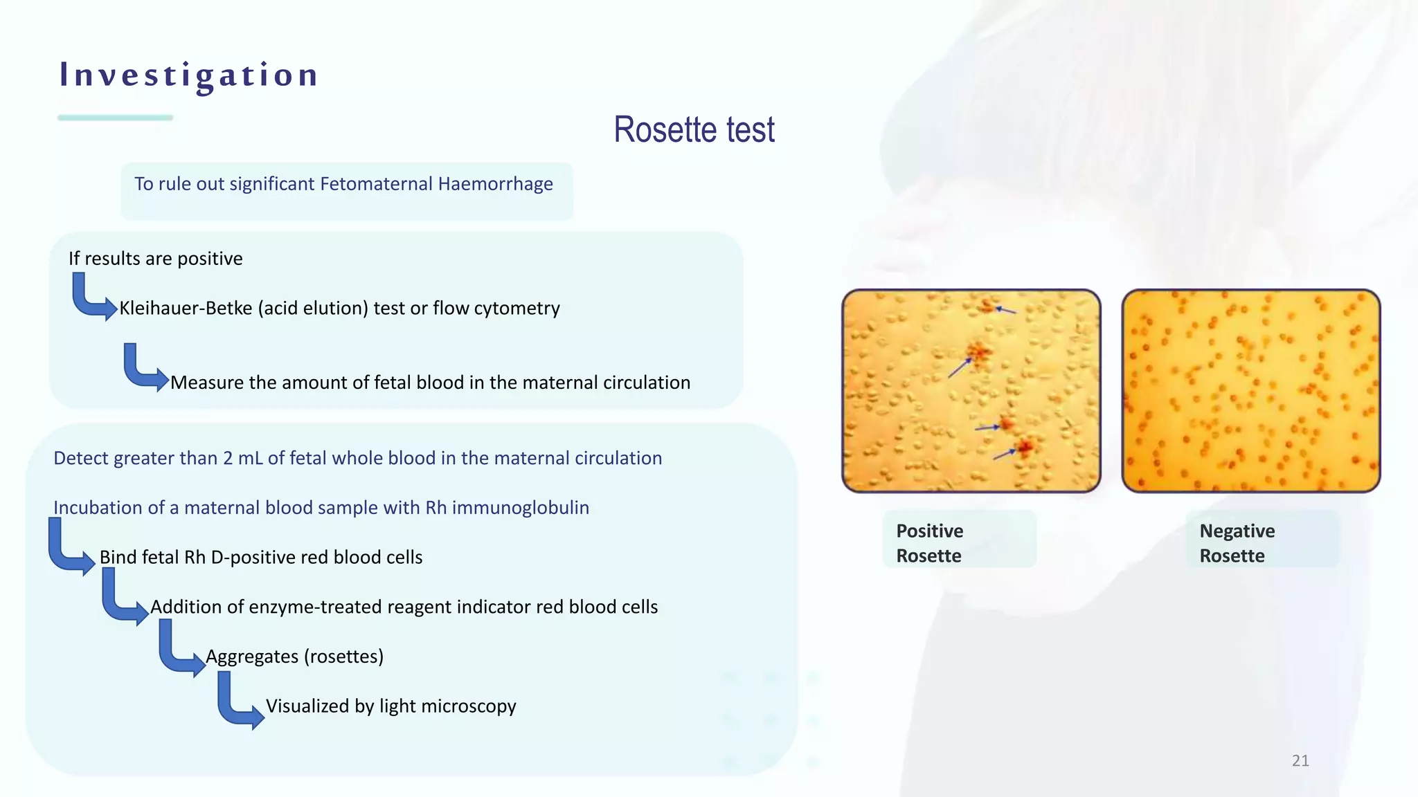 RH ISO IMMUNISATION.pptx 2.pptx
