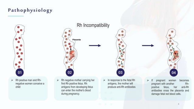 RH ISO IMMUNISATION.pptx 2.pptx