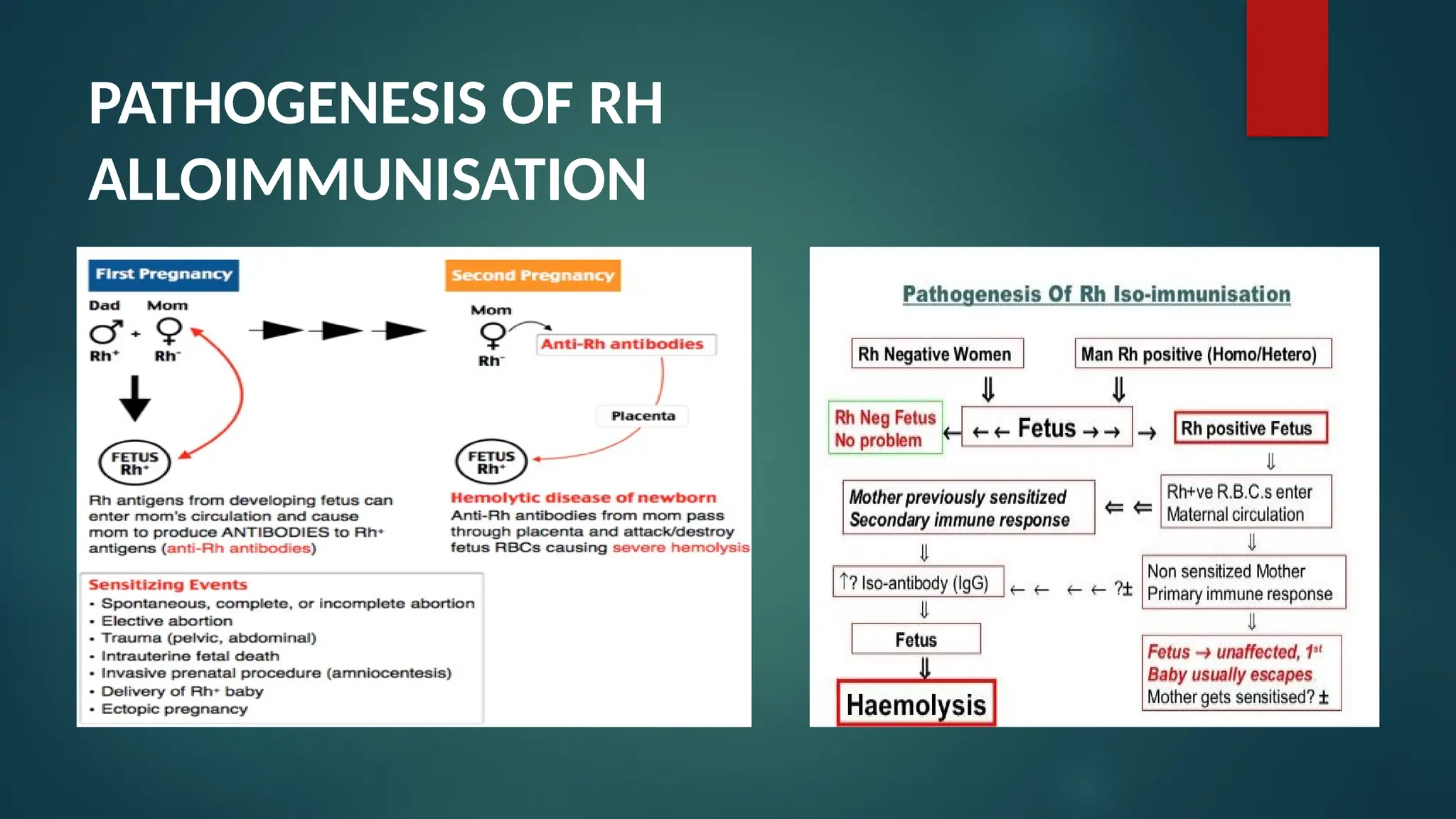 Rh isoimmunisation and its complication ppt.pptx