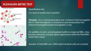 Rh isoimmunisation and its complication ppt.pptx