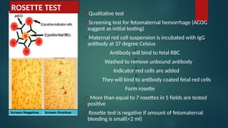 Rh isoimmunisation and its complication ppt.pptx