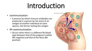 Rh isoimmunization | PPTX