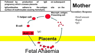Rh isoimmunization | PPTX