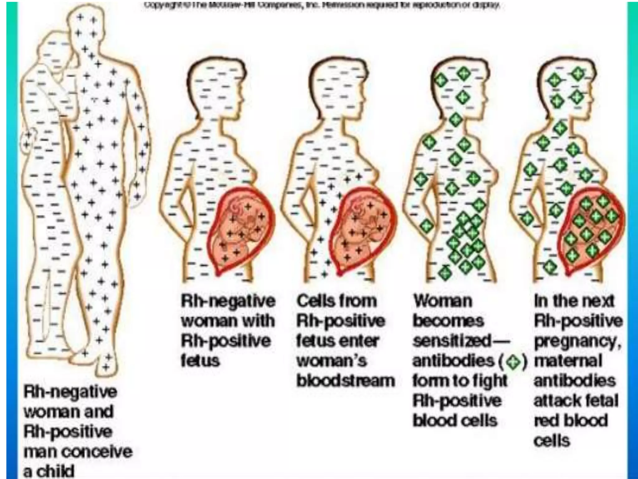 Rh isoimmunization | PPTX