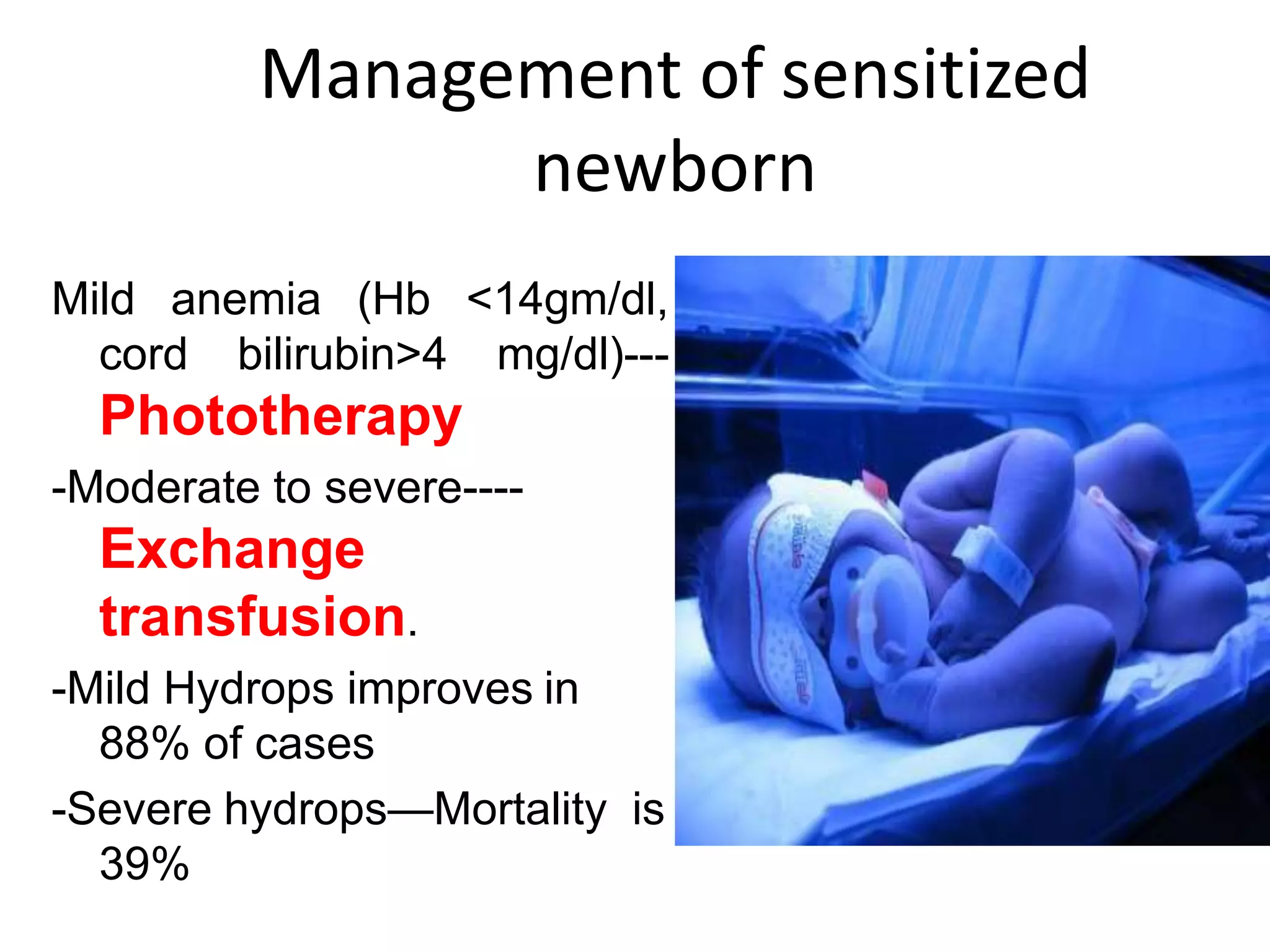 Rh isoimmunization | PPTX