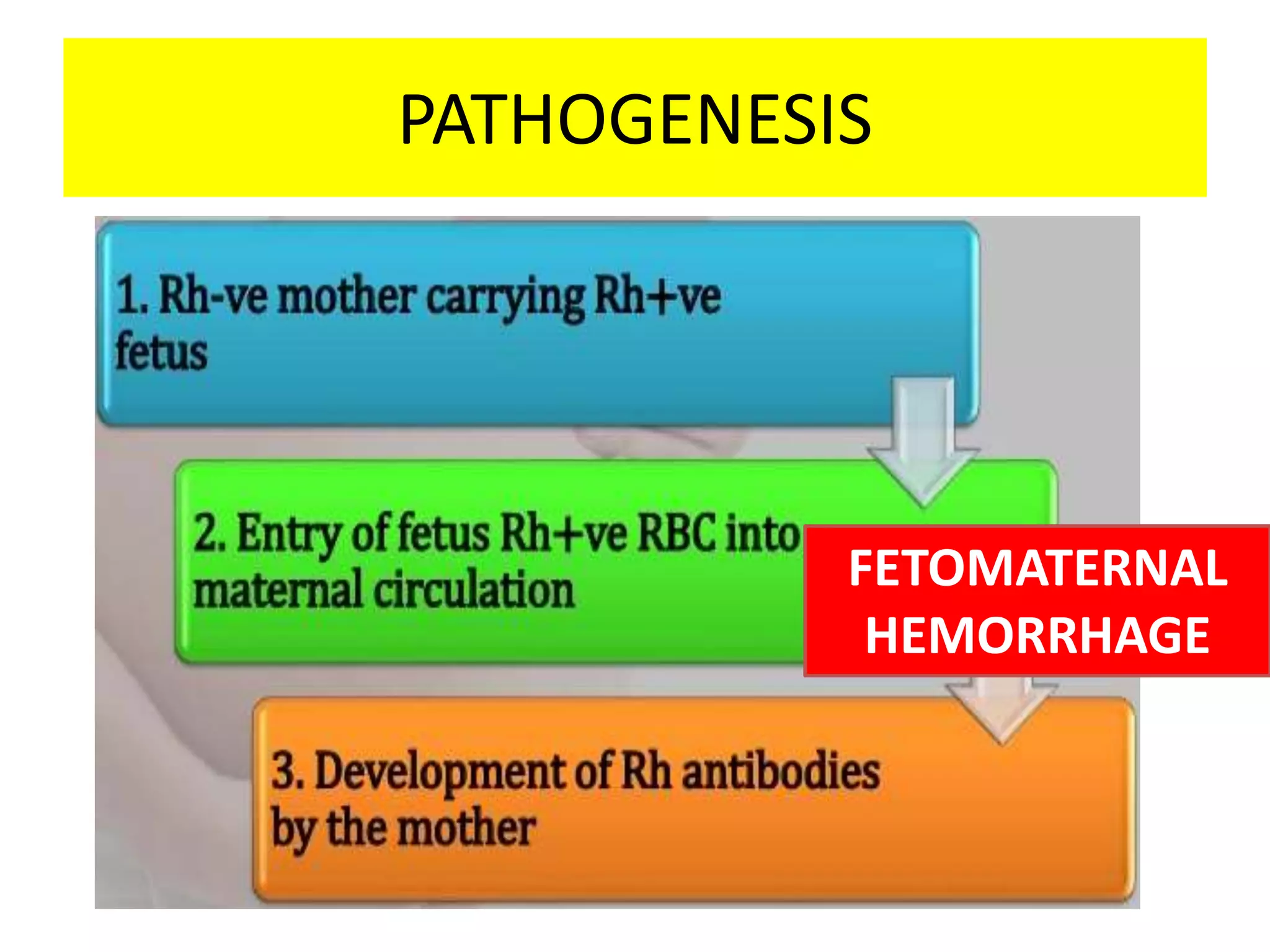 Rh isoimmunization | PPTX