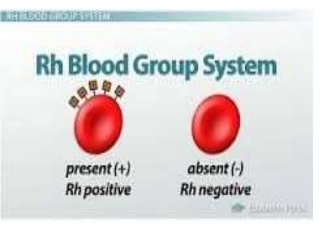Rh isoimmunization | PPT
