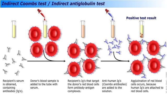 RH ISOIMMUNIZATION BWIRE2.pptx | Pregnancy | Reproductive Health