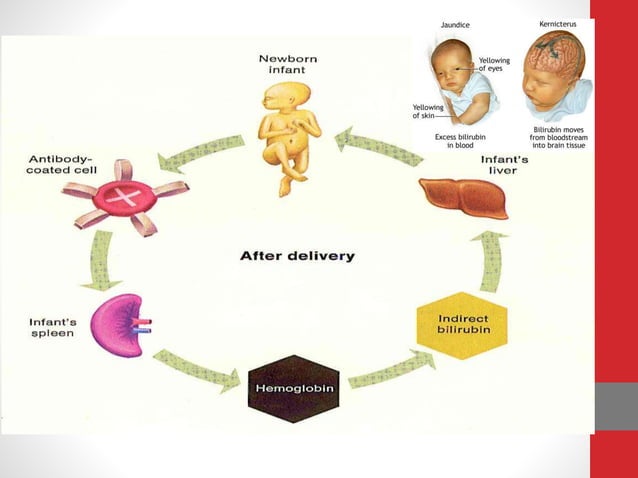 rh isoimmunization my.pptx