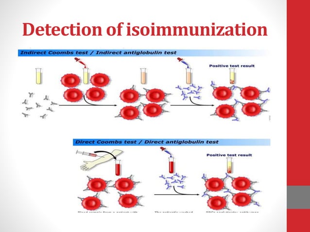 rh isoimmunization my.pptx