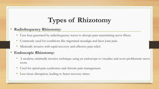 Rhizotomy:A surgical intervention for spasticity.pptx