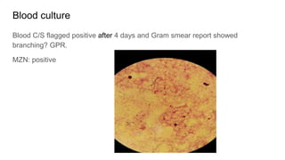 Rhodococcus.pptx | Infectious Diseases | Diseases and Conditions