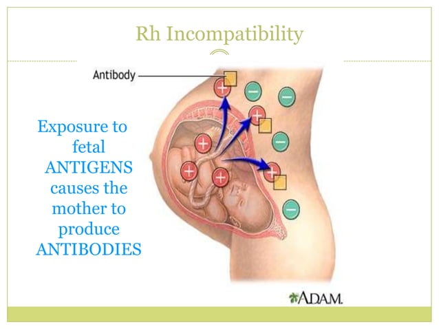 Rh Rhesus Isoimmunization | PPTX