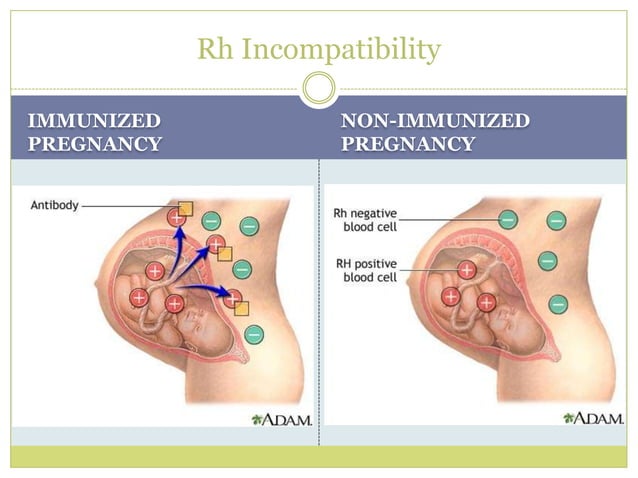 Rh Rhesus Isoimmunization | PPTX