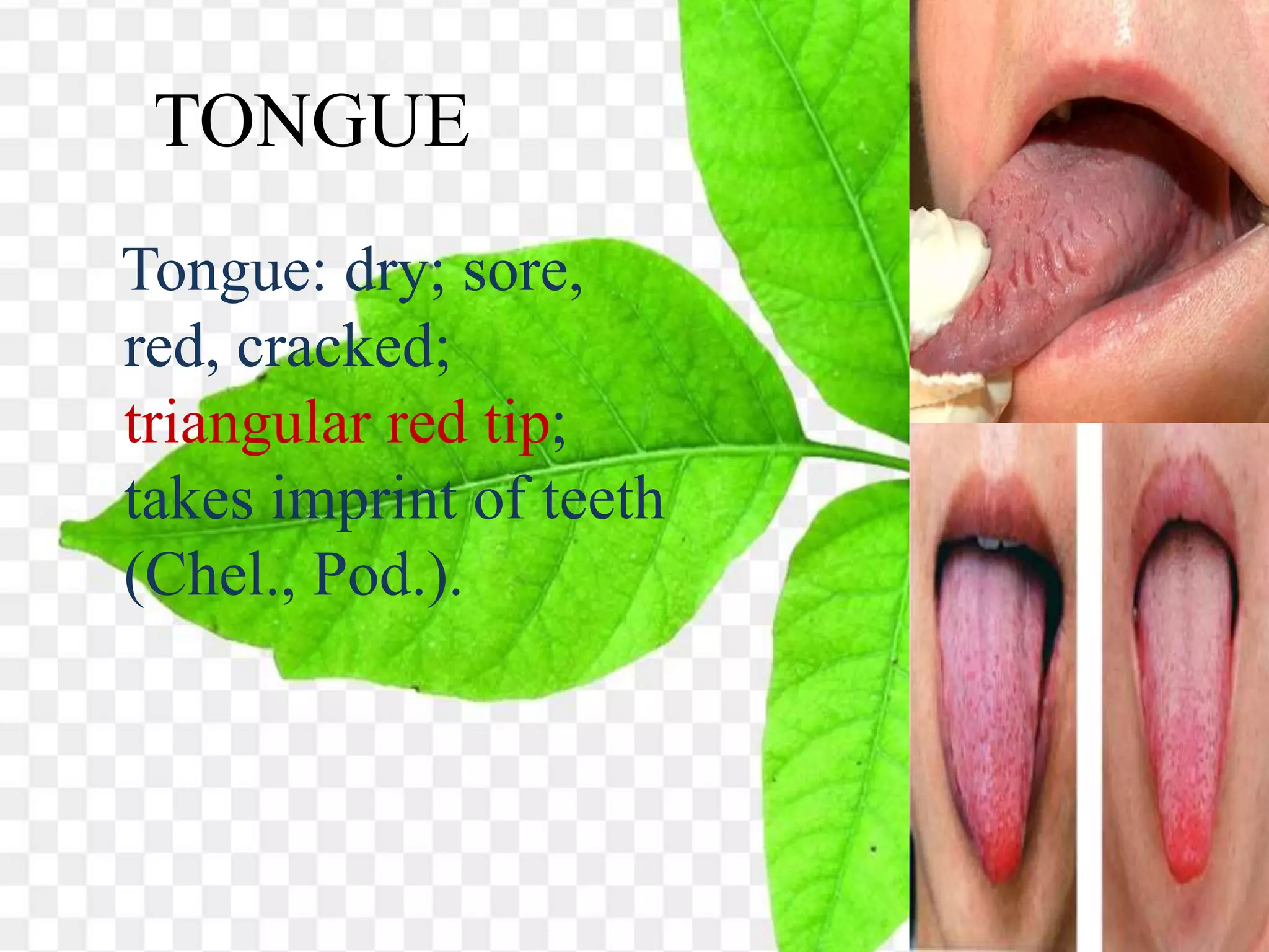 Rhux tox Drug Picture | PPTX