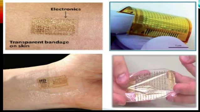 Electronic skin | PPTX | Skin and Dermatology | Diseases and Conditions