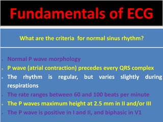 ECG Rhythm abnormality for undergraduates | PPSX